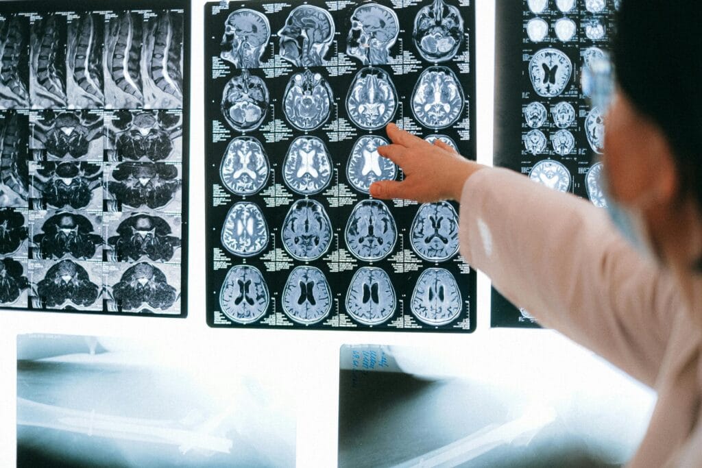 Understanding Different Types of Diagnostic Imaging Available in ...